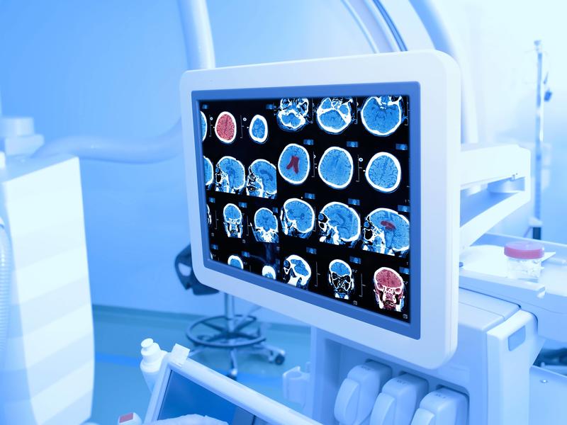 Neurosciences | Neurosurgery I Neurology I Stroke Center I CAMC